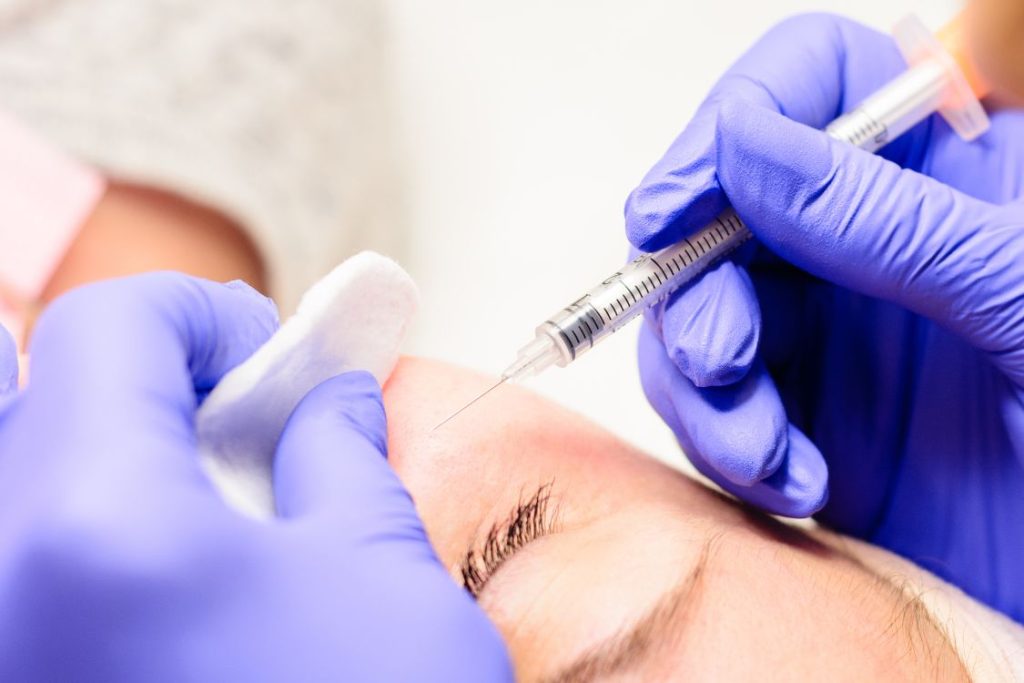 Milia Removal - SB Cosmetics Clinic